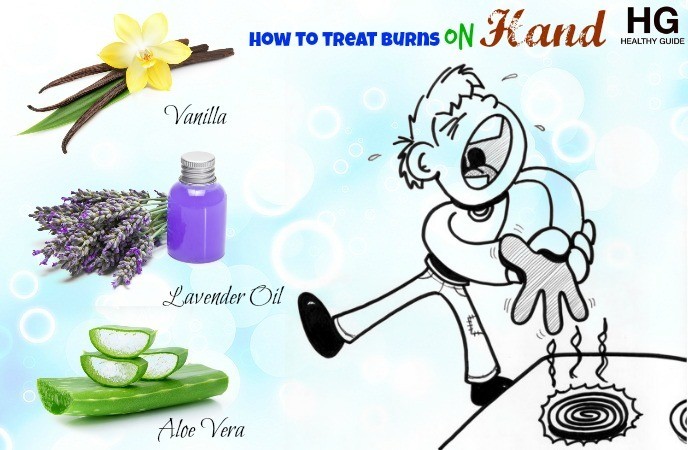 29 Tips How To Treat Burns On Face, Skin, Fingers, & Hand At Home