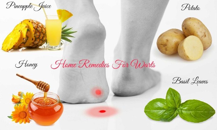 25 Home Remedies For Warts On Face, Neck, Hands And Feet