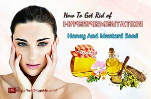 34 Tips How To Get Rid Of Hyperpigmentation On Face, Neck, Legs, Back