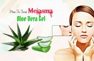 30 Tips How To Treat Melasma On Face & Upper Lips Fast & Naturally