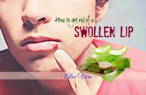 22 Tips How To Get Rid Of A Swollen Lip From A Cold Sore & Pimple Fast