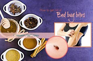 Top 37 Tips How to Get Rid of Bed Bug Bites on Skin Fast