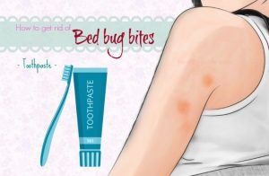 Top 37 Tips How to Get Rid of Bed Bug Bites on Skin Fast