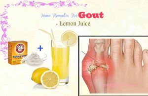 38 Home Remedies For Gout In Foot, Shoulder, Wrist, Leg, Arm, & Knee