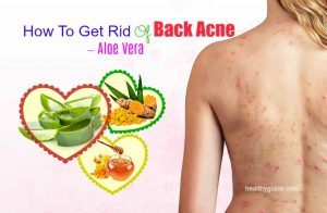 10 Tips How to Get Rid of Back Acne Spots & Scars Fast Overnight at Home