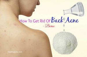10 Tips How to Get Rid of Back Acne Spots & Scars Fast Overnight at Home