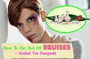 22 Tips How to Get Rid of Bruises on Lips, Face, Shins, and Hands Fast
