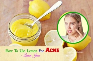 30 Tips How to Use Lemon for Acne and Pimples Scars, Spots Removal ...