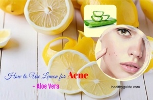 30 Tips How to Use Lemon for Acne and Pimples Scars, Spots Removal ...