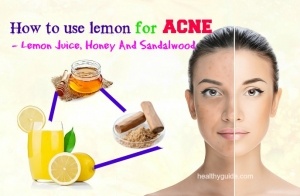 30 Tips How to Use Lemon for Acne and Pimples Scars, Spots Removal ...