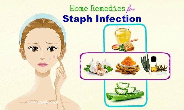 14 Home Remedies for Staph Infection Pain on Face, Scalp, Buttocks ...